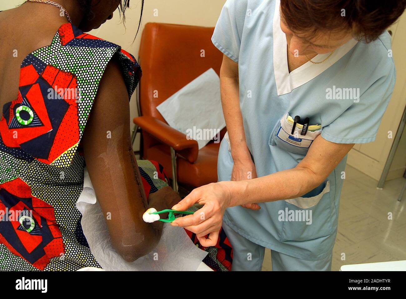 Wound cleaning. Nurse cleaning a surgical wound on a patient's arm by ...