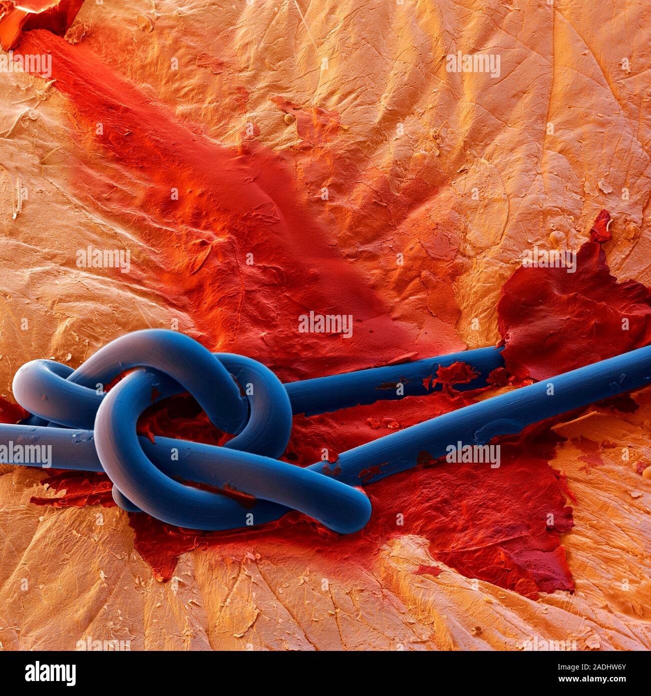 Sutured wound. Coloured scanning electron micrograph (SEM) of a suture ...