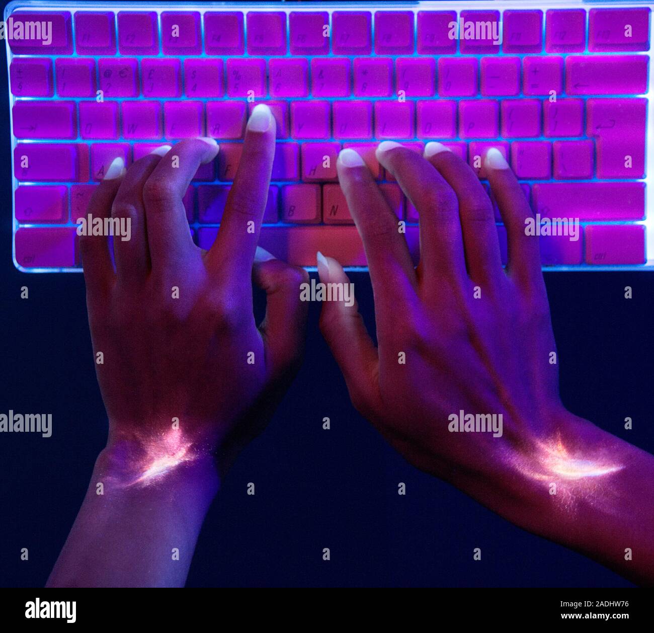 Repetitive strain injury. Conceptual image taken in ultraviolet light ...