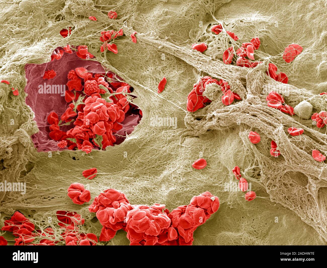 Healing skin wound, coloured scanning electron micrograph (SEM). A ...