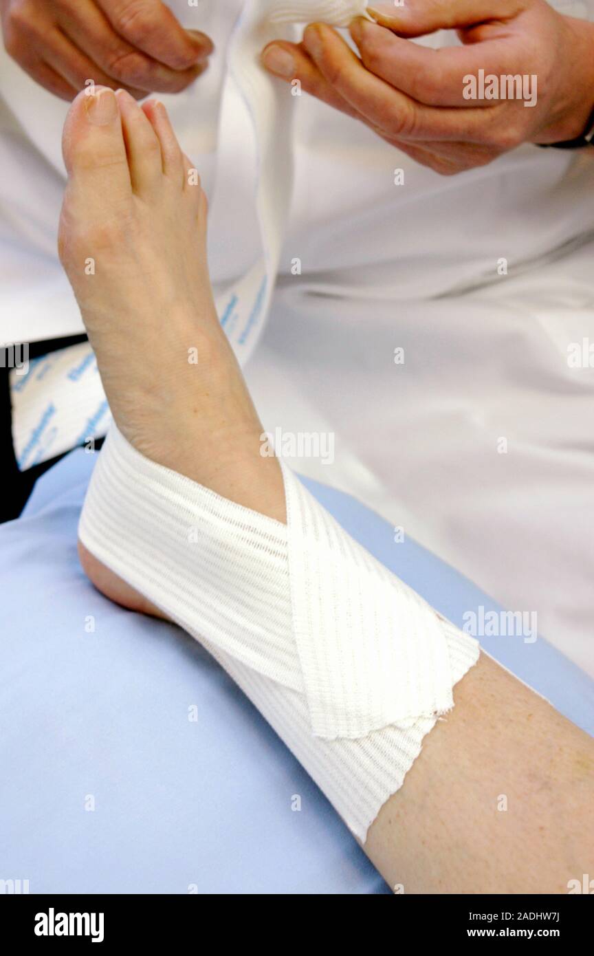 Ankle injury. Image 2 of 4. Nurse applying layers of bandaging to a ...