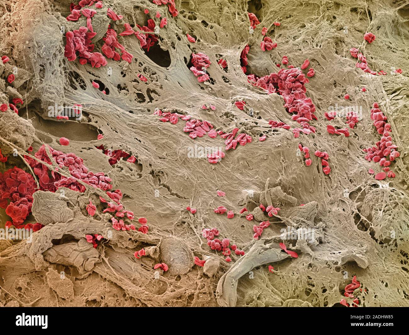 Healing wound. Coloured scanning electron micrograph (SEM) of a healing ...
