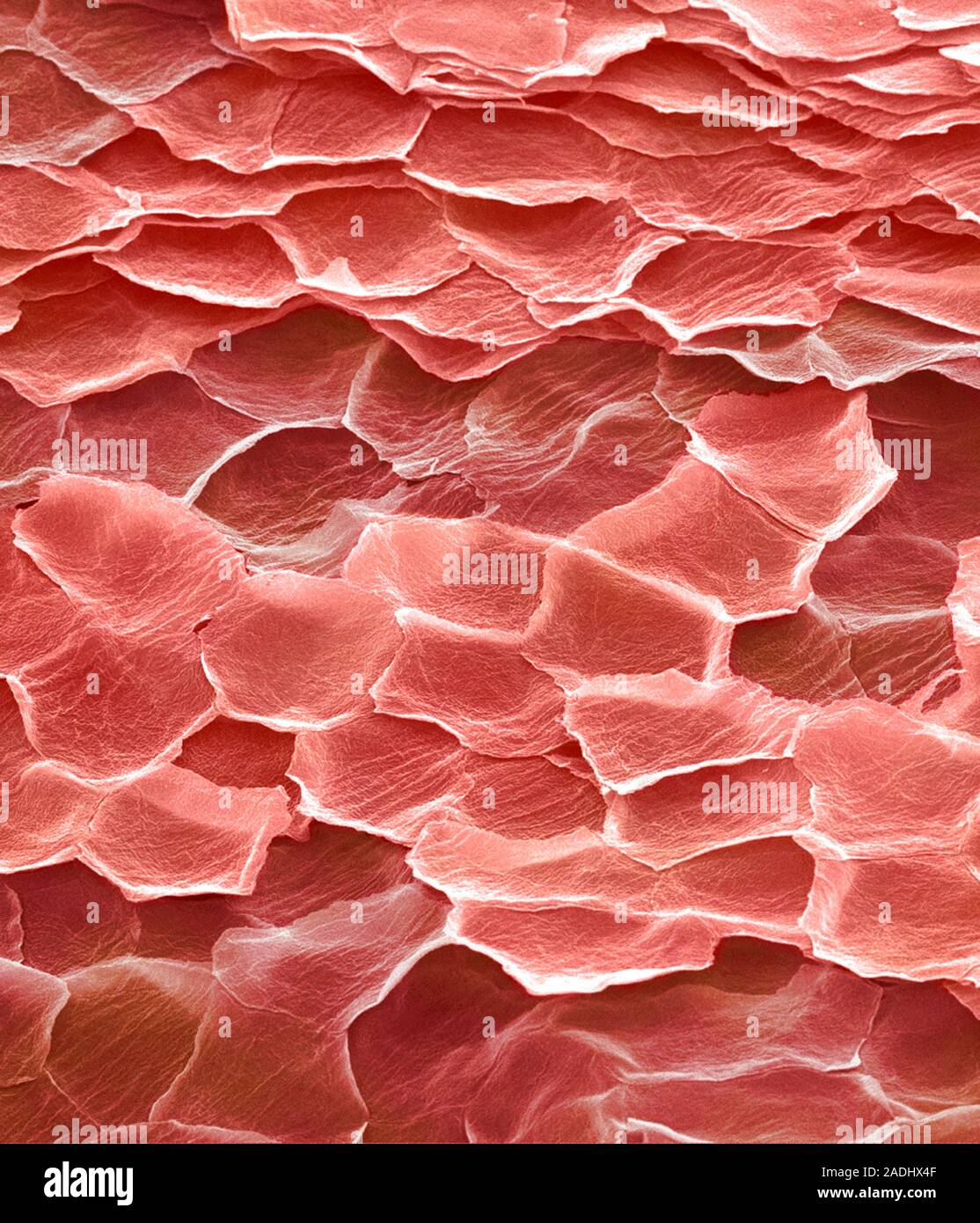 Epidermal Skin Cell