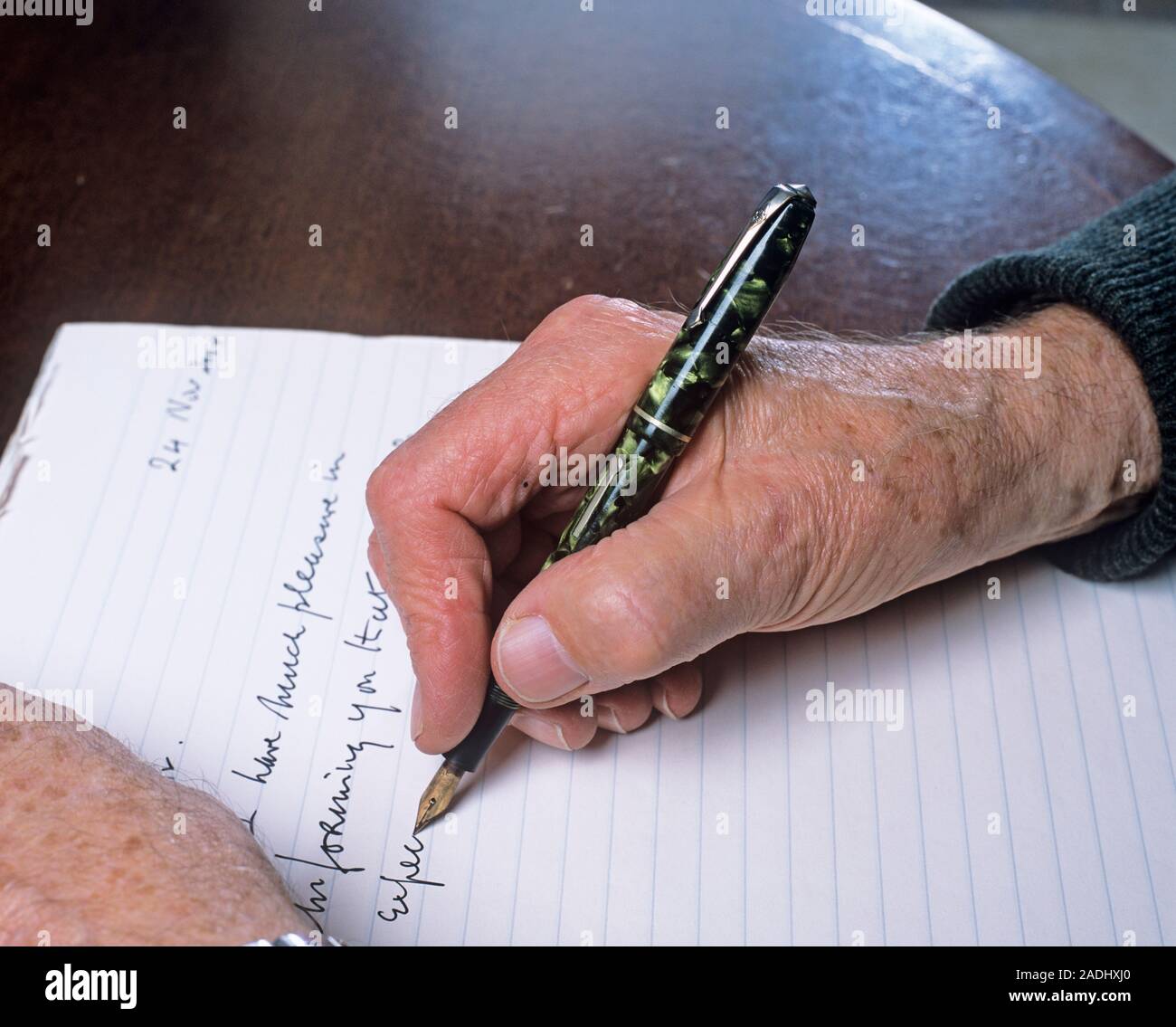 Elderly person writing a letter. They have inflamed joints in their ...