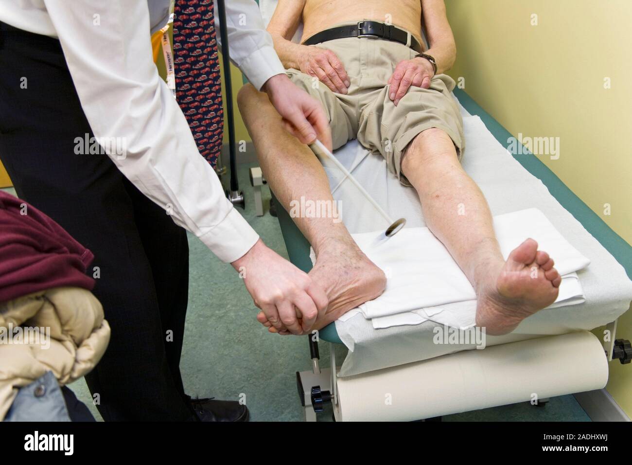 Ankle reflex test. Doctor performing a reflex test with a hammer on a ...