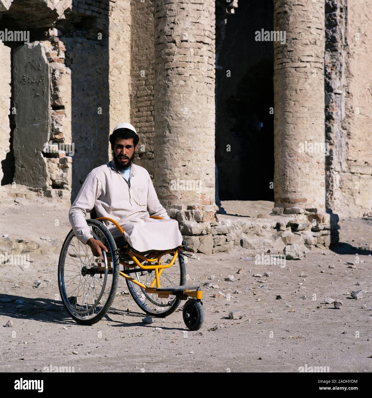 Disability. Double above-the-knee amputee sitting in his wheelchair ...