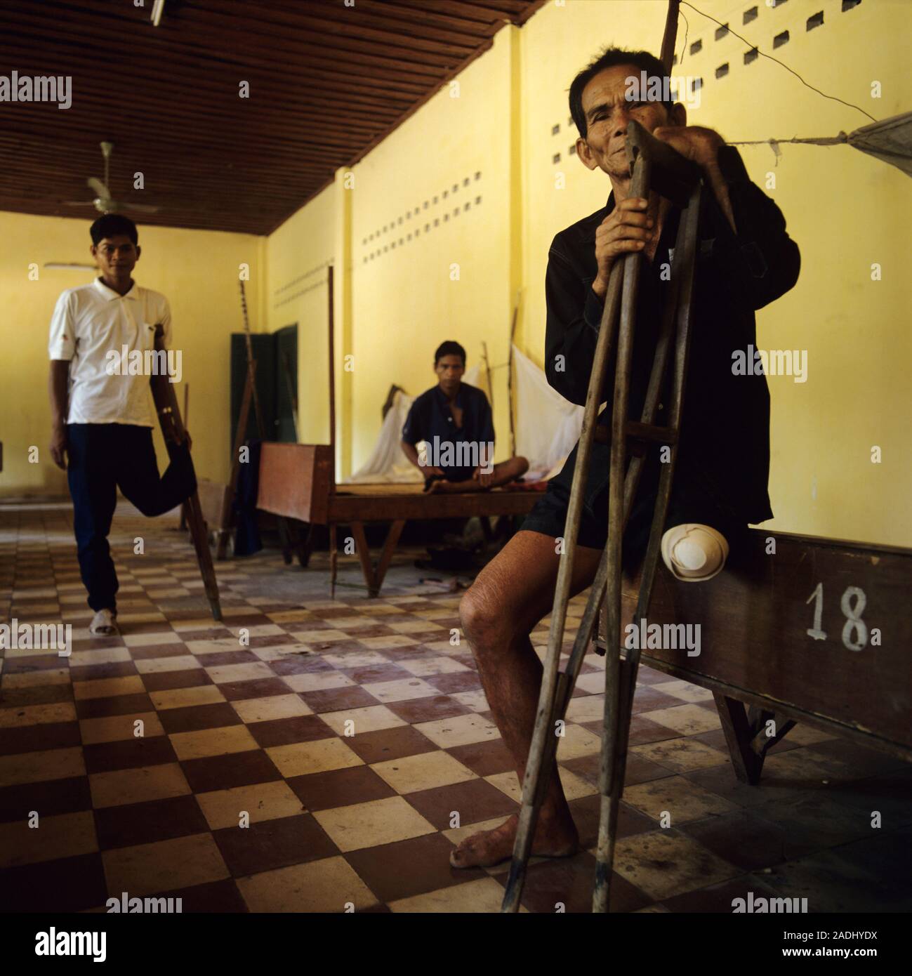 Disability. Amputees requiring prosthetic limbs. They each lost a leg ...