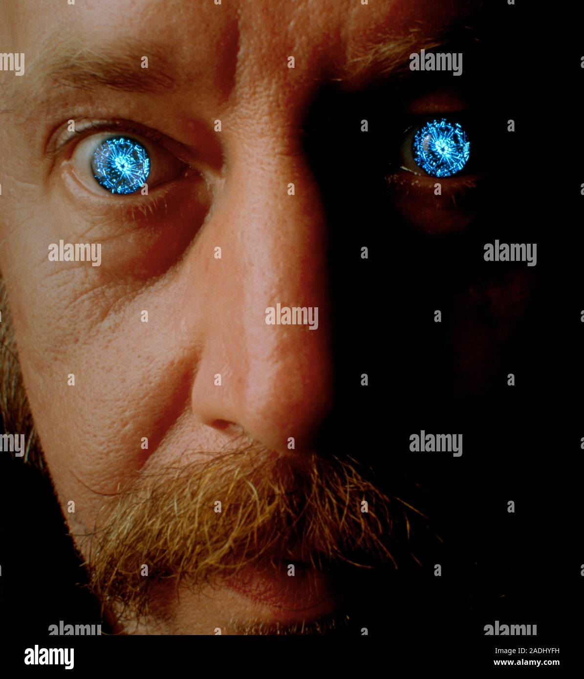 Blindness. Conceptual image showing a man with shattered eyes, to ...