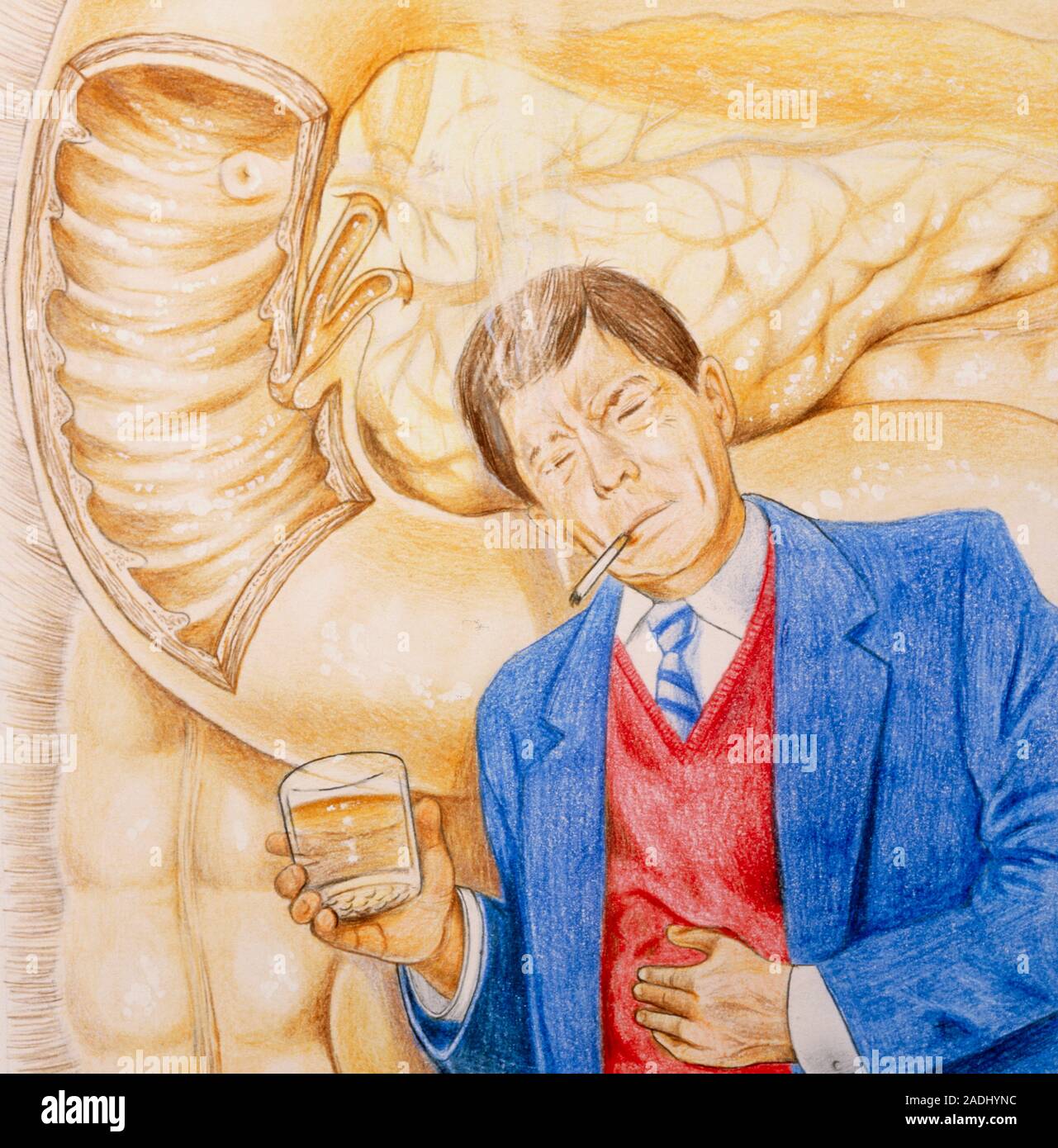 Pancreatitis. Illustration of a person suffering from a strong ...