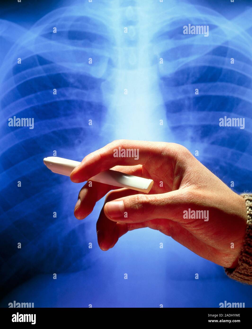 Nicotine inhaler. Hand holds a Nicorette nicotine drug inhaler in front ...