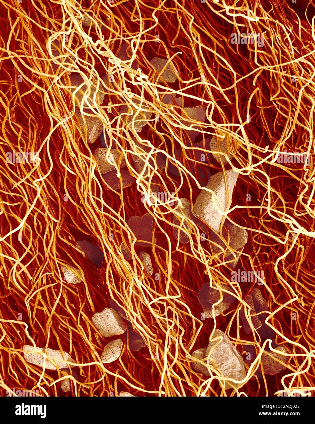 Cigarette filter. Coloured scanning electron micrograph (SEM) of the ...