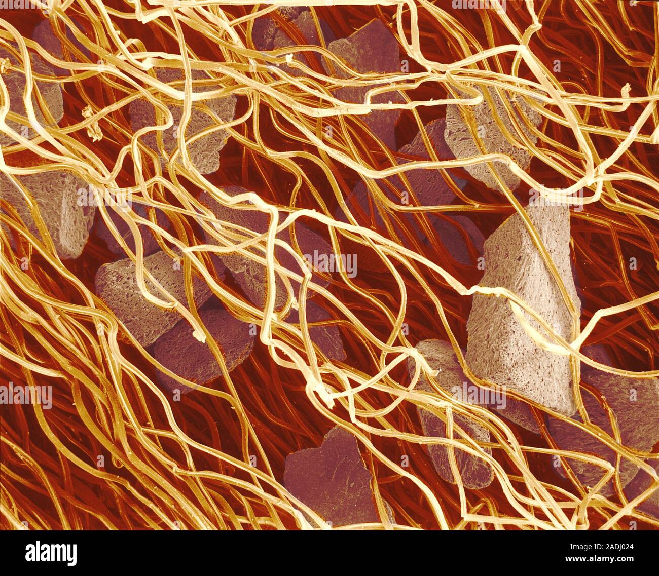 Cigarette filter. Coloured scanning electron micrograph (SEM) of the ...