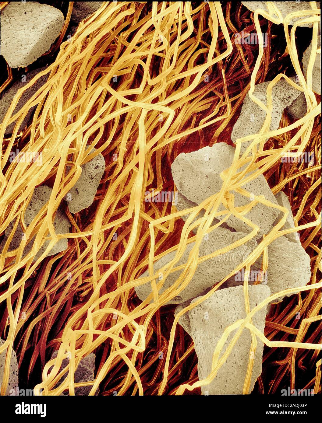 Cigarette filter. Coloured scanning electron micrograph (SEM) of the ...