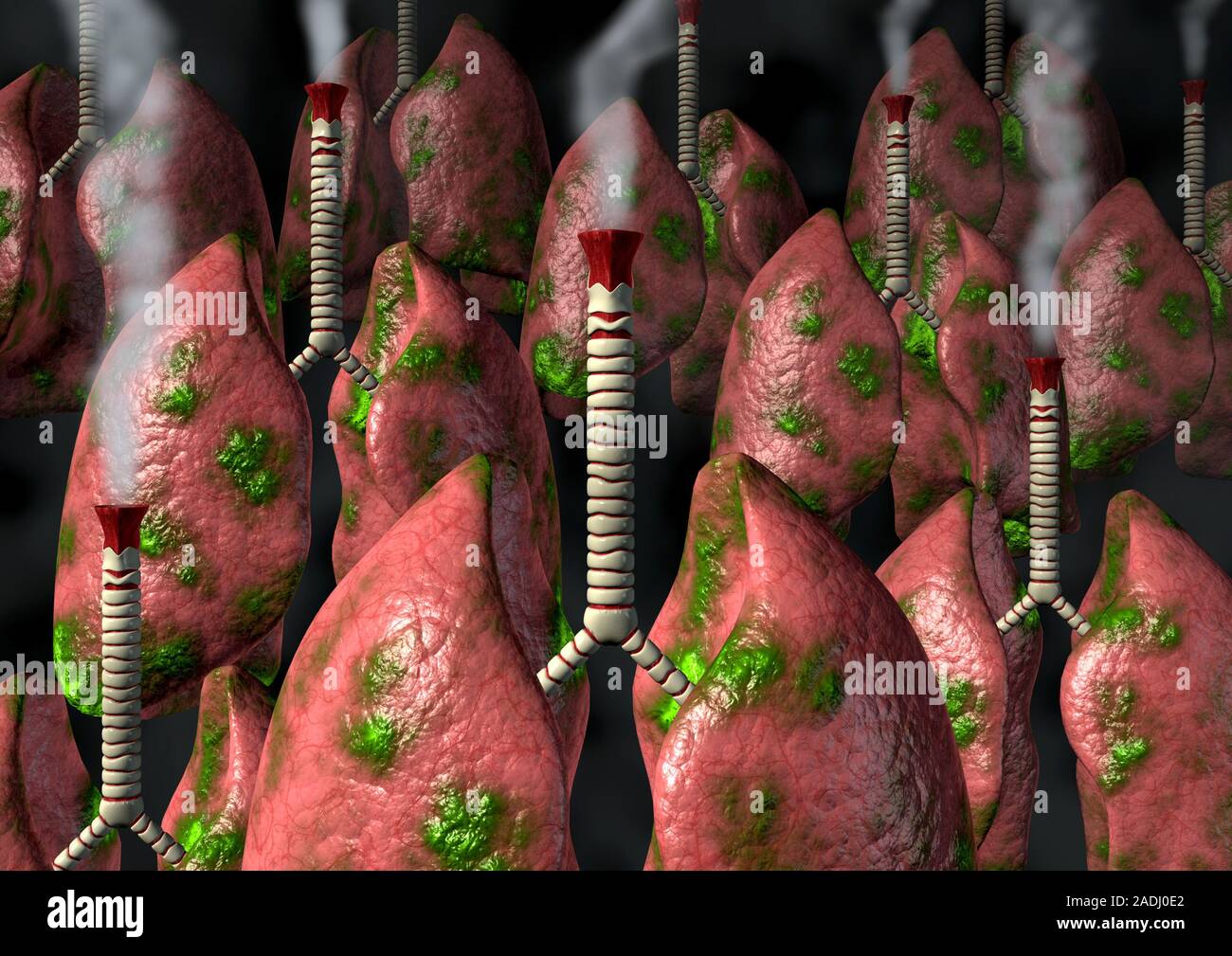 Smoker's lungs. Conceptual image of a smoker's lungs, with smoke rising ...