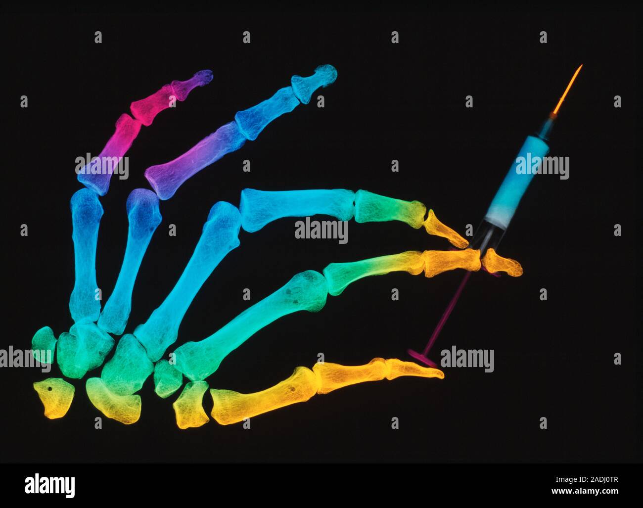 Drug death. Conceptual coloured X-ray image of a hand holding a syringe ...