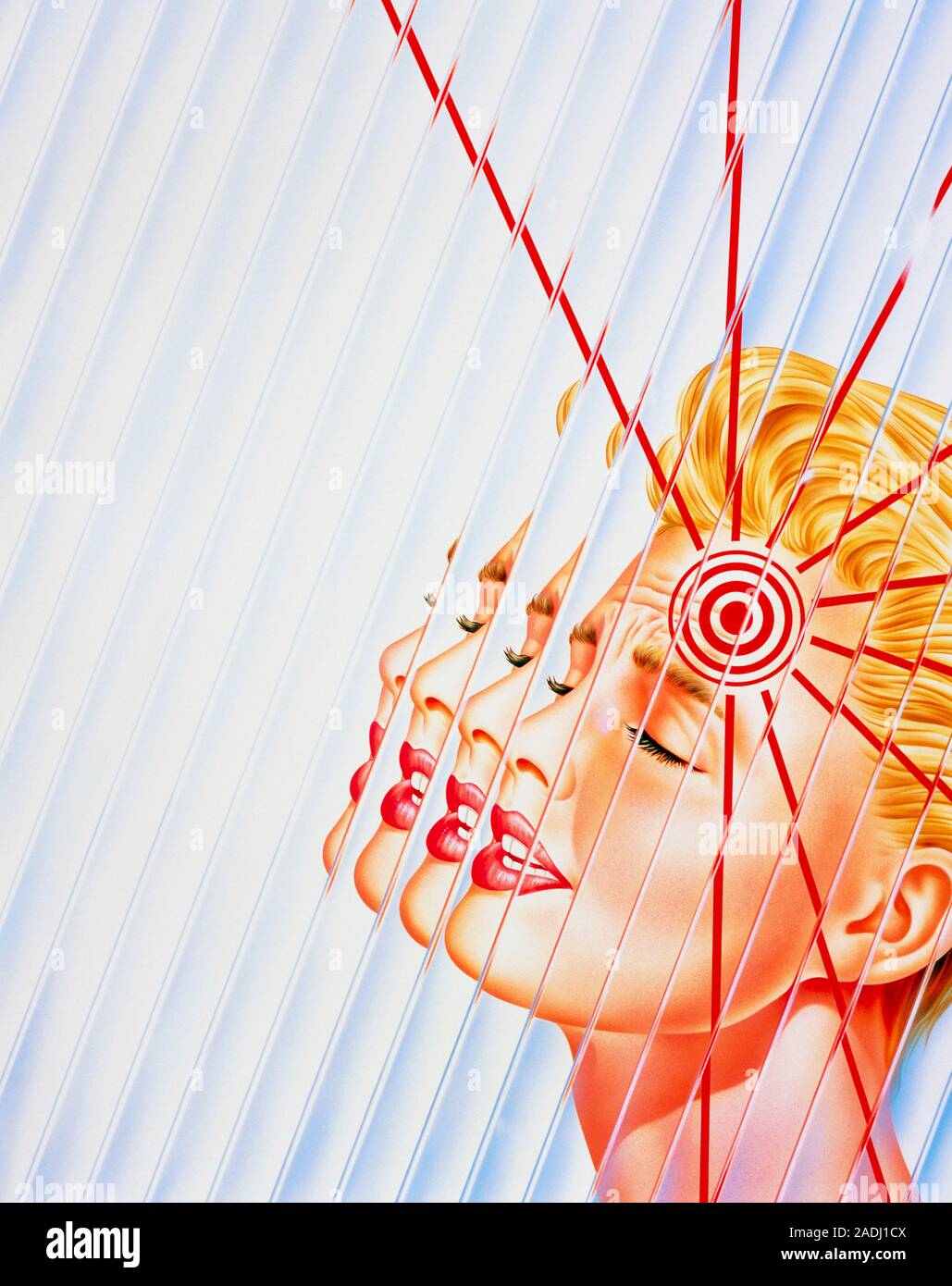 Headache. Abstract illustration of a woman enduring extreme head pain ...