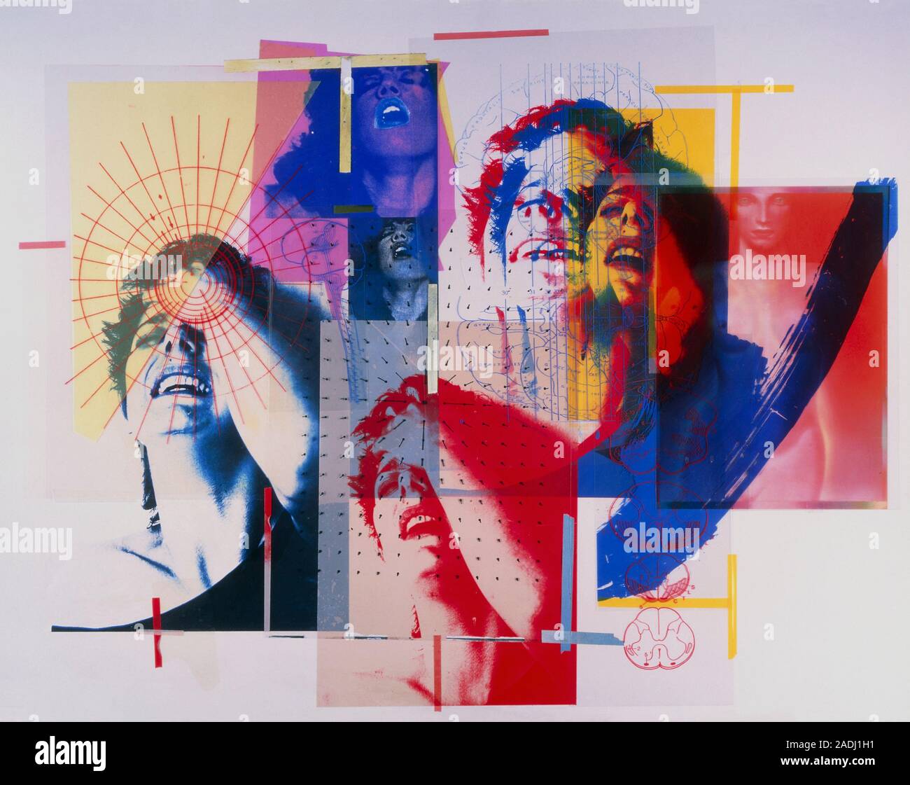 Migraine headache. Conceptual computer artwork showing women with ...