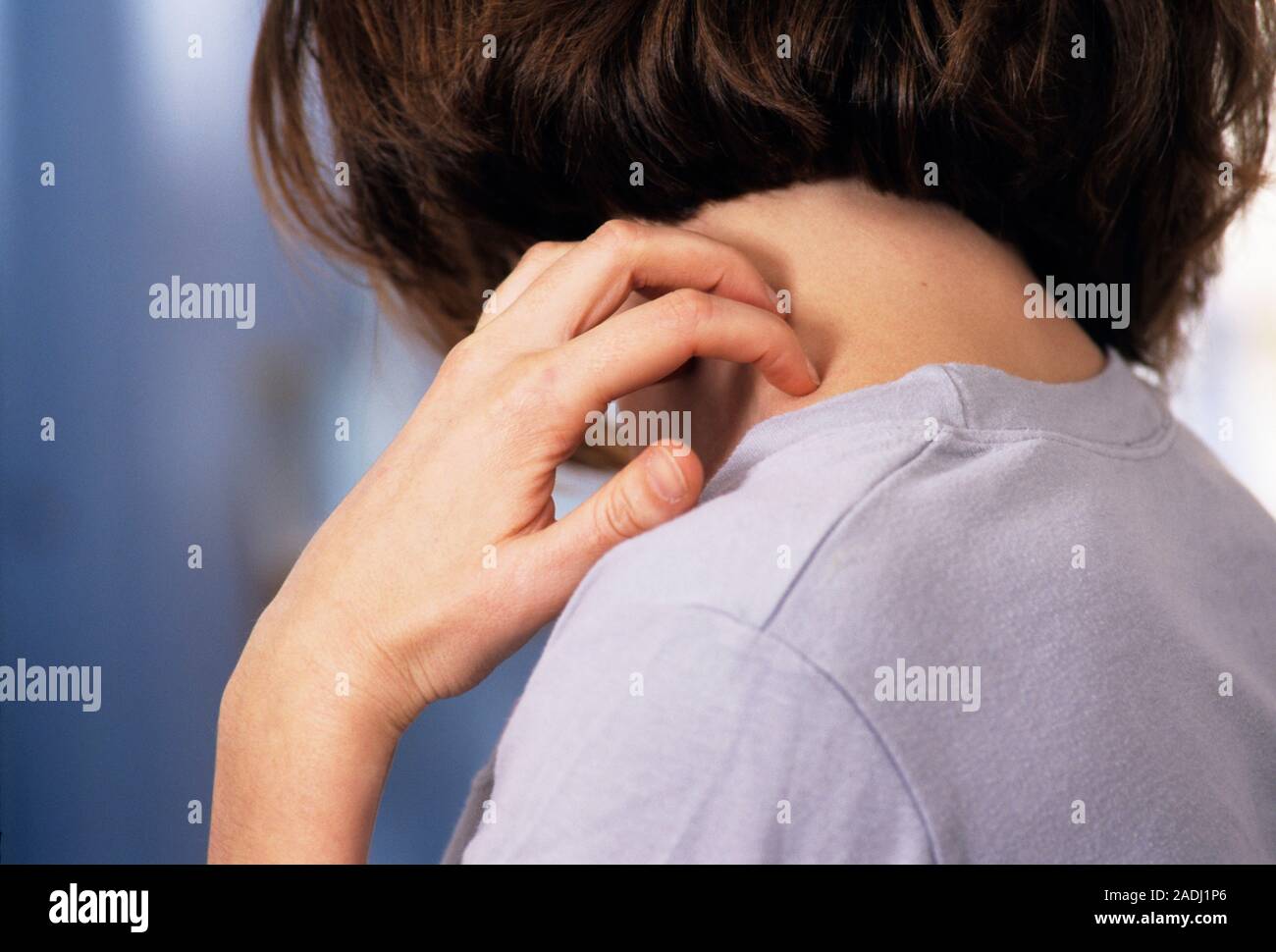 Itchy skin. Woman scratching her itchy neck Stock Photo - Alamy