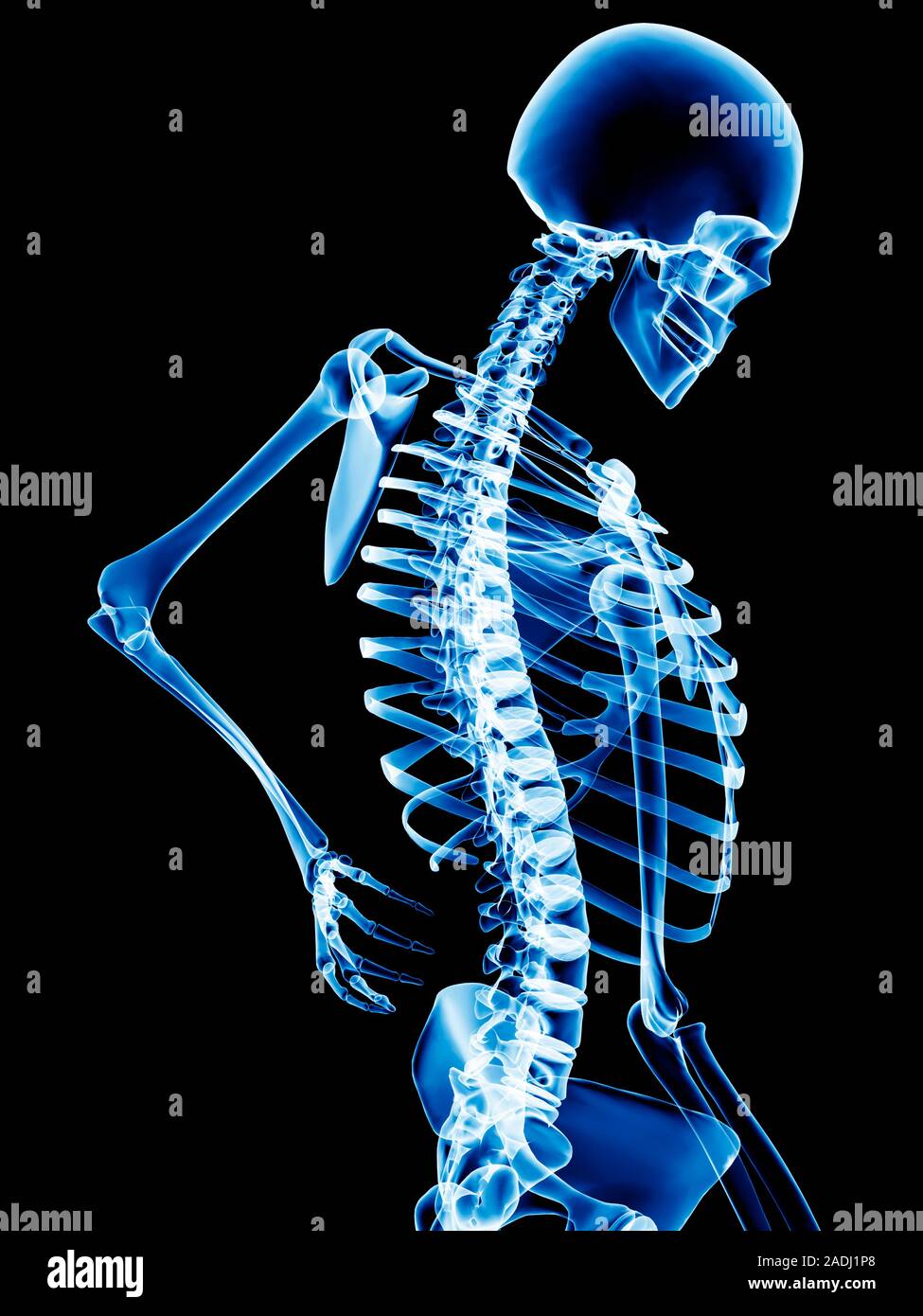 Back pain. Computer artwork of a human skeleton holding a hand to the ...
