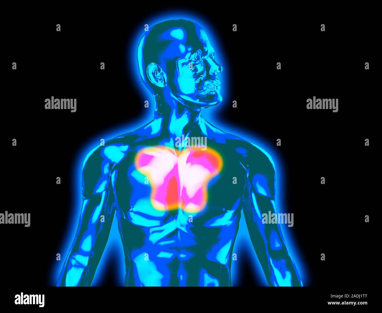 Chest pain. Conceptual computer artwork of chest pain, shown as red ...