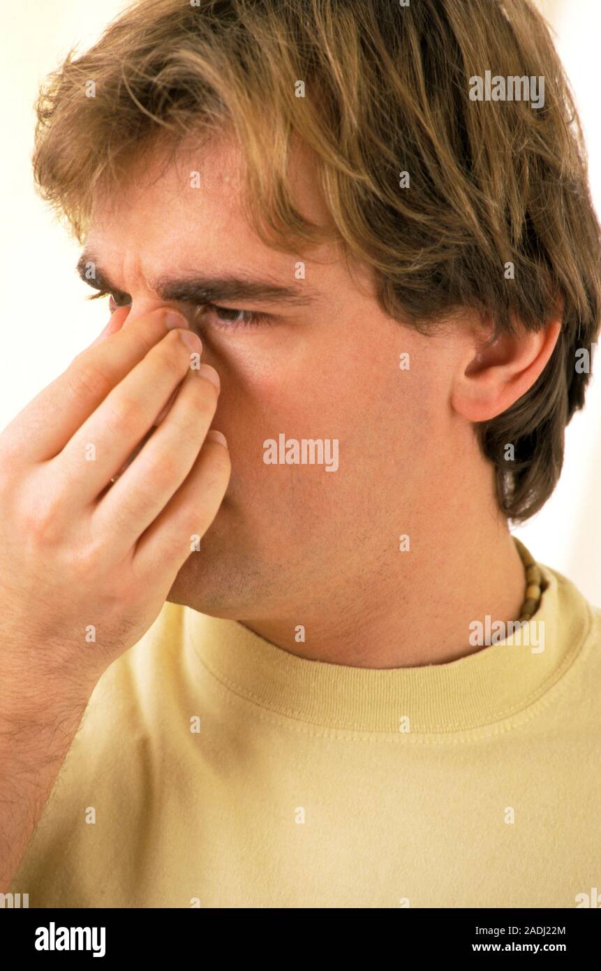 MODEL RELEASED. Sinus pain. Man holding the bridge of his nose in pain ...