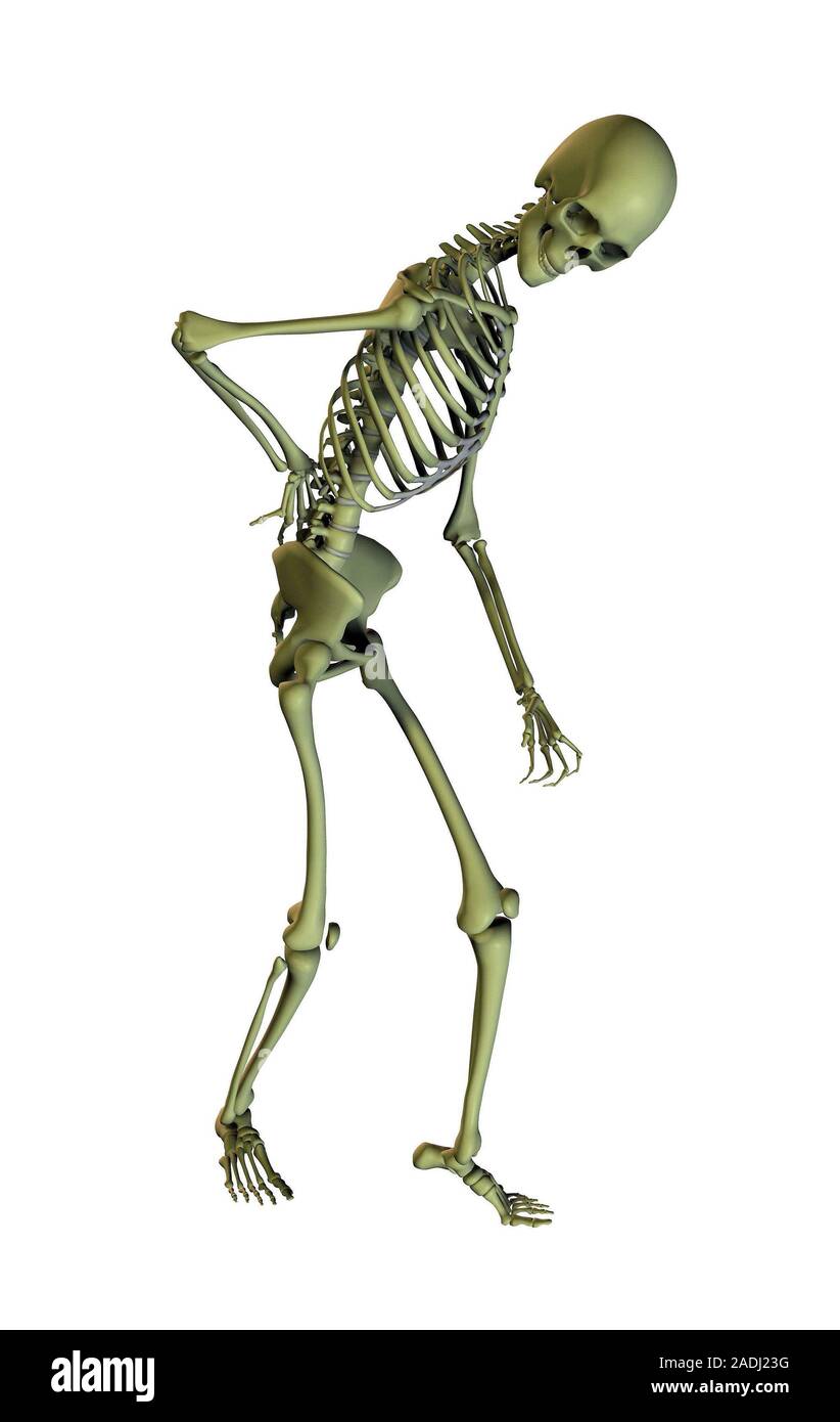 Back pain. Computer artwork of a skeleton holding its lower back in ...