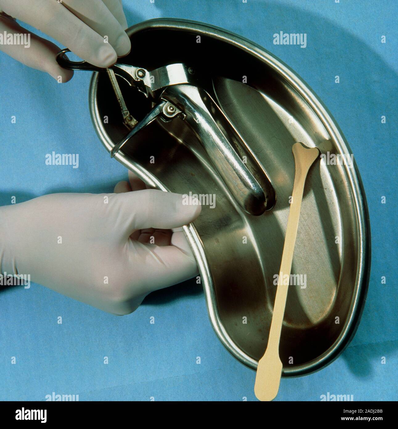 Cervical smear equipment. Kidney dish containing a metal vaginal ...