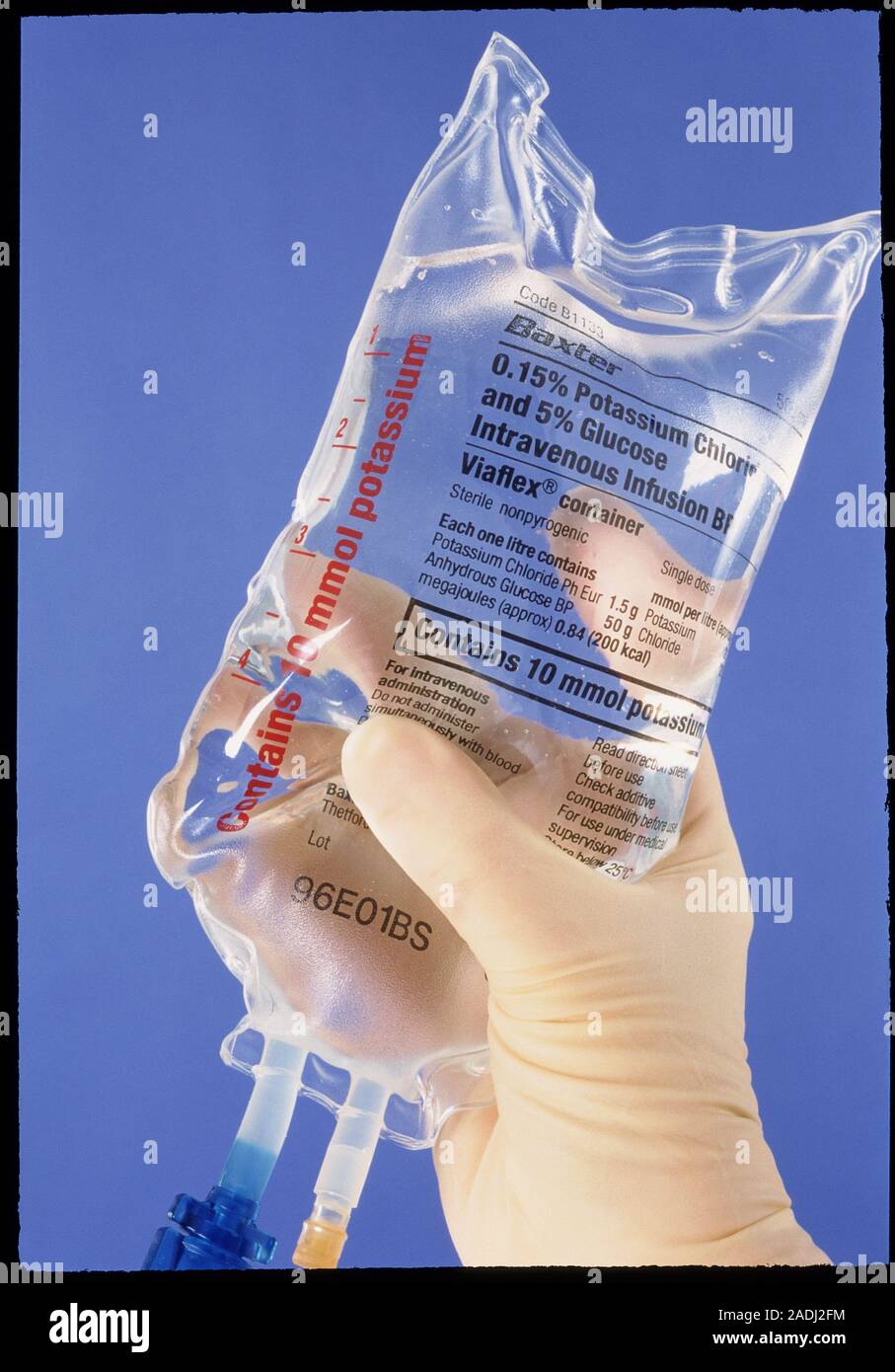 Intravenous drip bag. Gloved hand holding an intravenous (IV) drip bag ...
