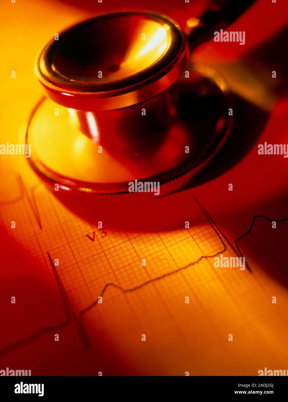 Stethoscope. View of a stethoscope and an electrocardiogram trace (ECG ...