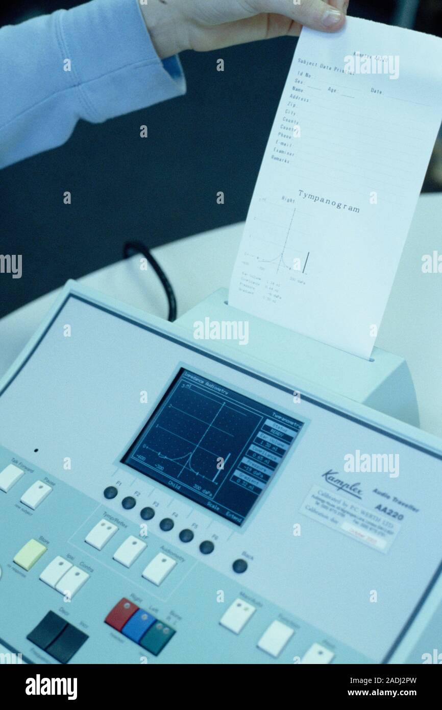 Tympanometry equipment used to measure the movement of the eardrum ...