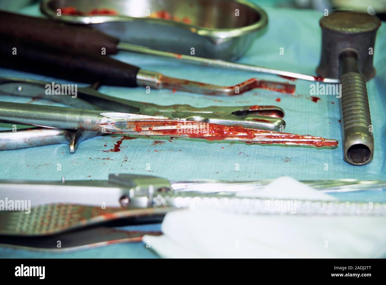 Hip surgery instruments covered in blood. These are used to remove bone ...