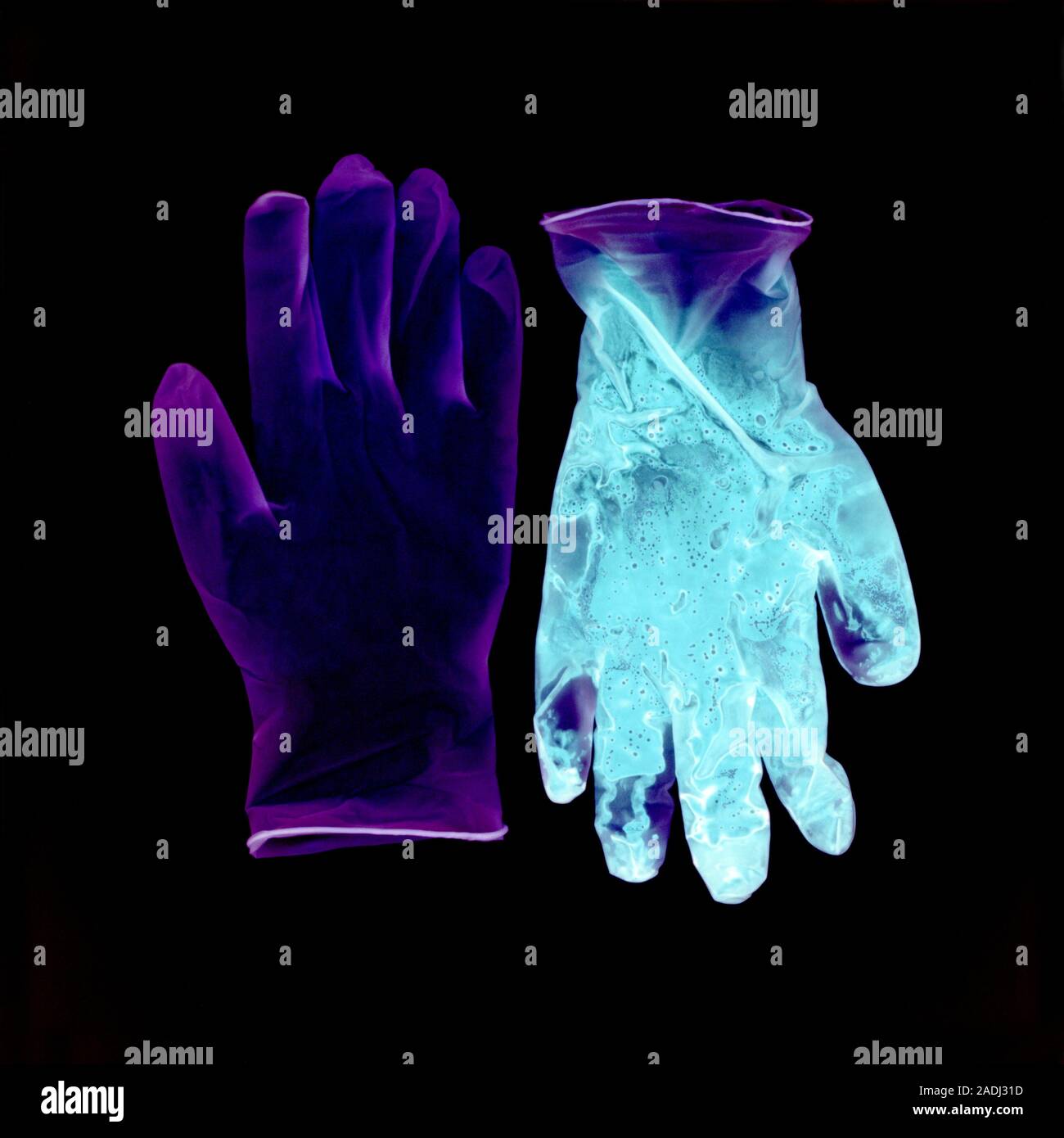 Surgical gloves. Negative image of surgical gloves, one (left) clean ...