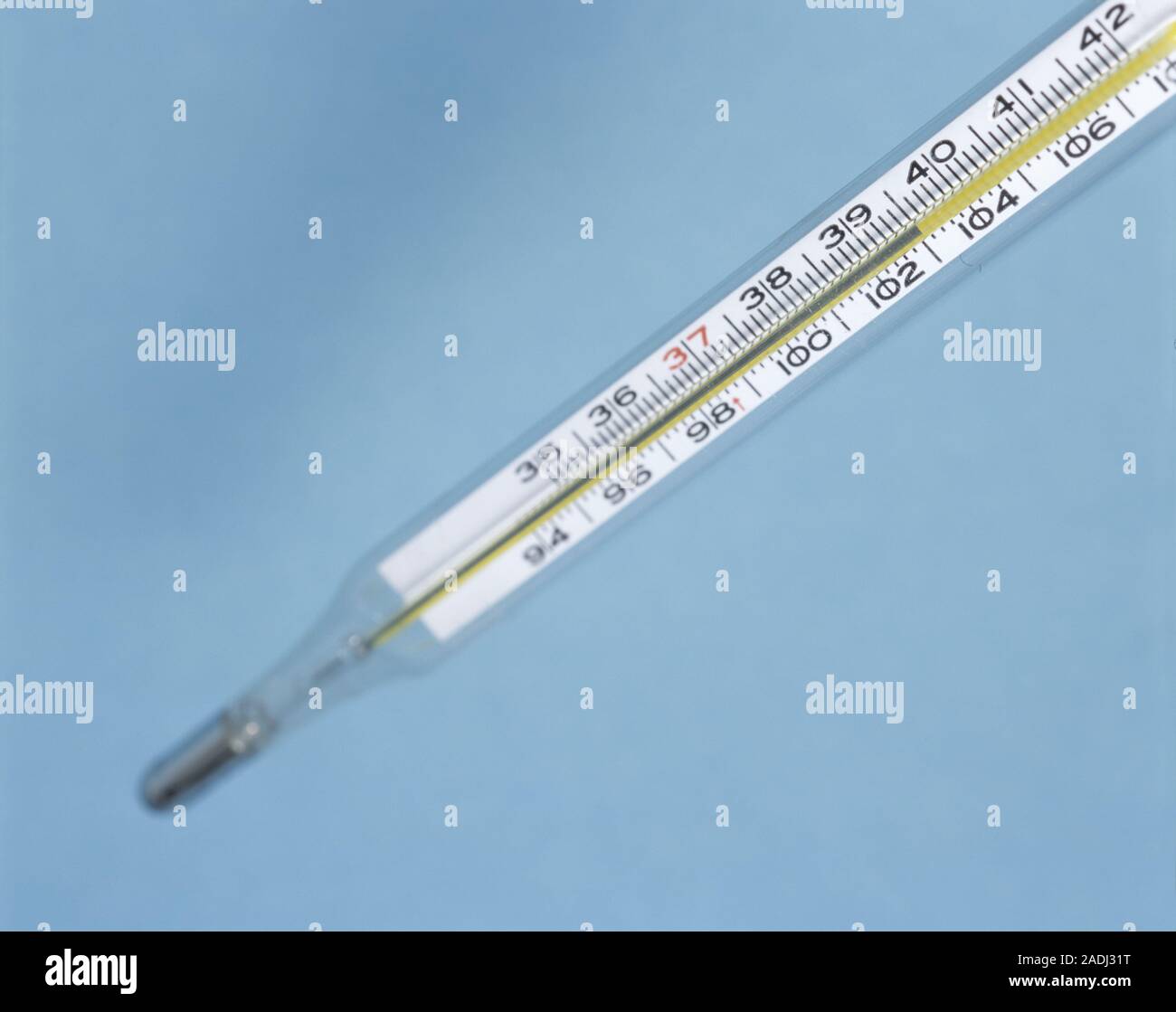Fever. Mercury thermometer showing a raised temperature of 39.5 degrees ...