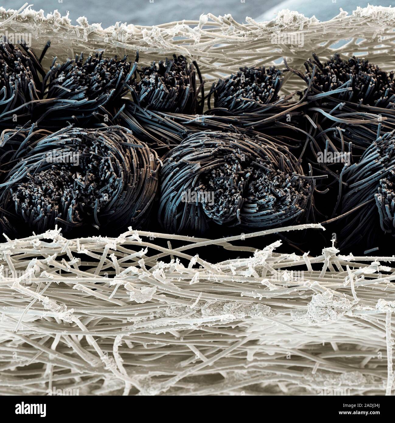 Silver-impregnated wound dressing. Coloured scanning electron ...