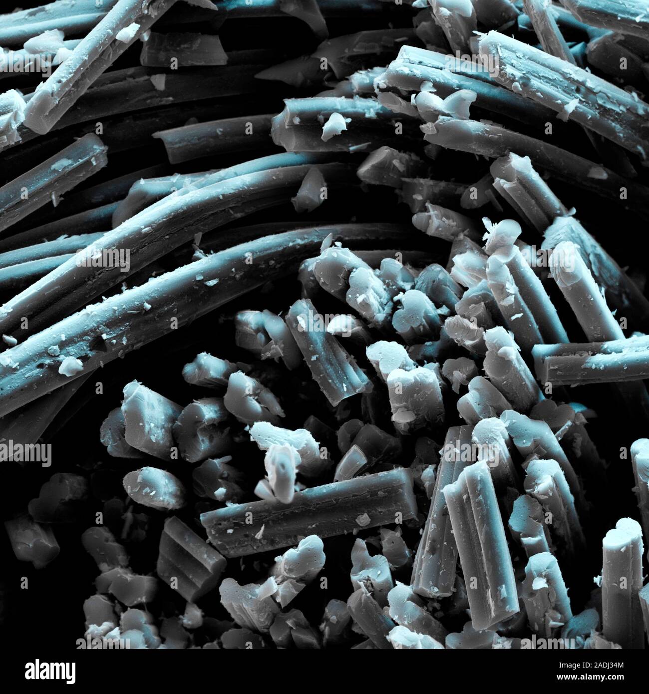 Silver-impregnated wound dressing. Coloured scanning electron ...