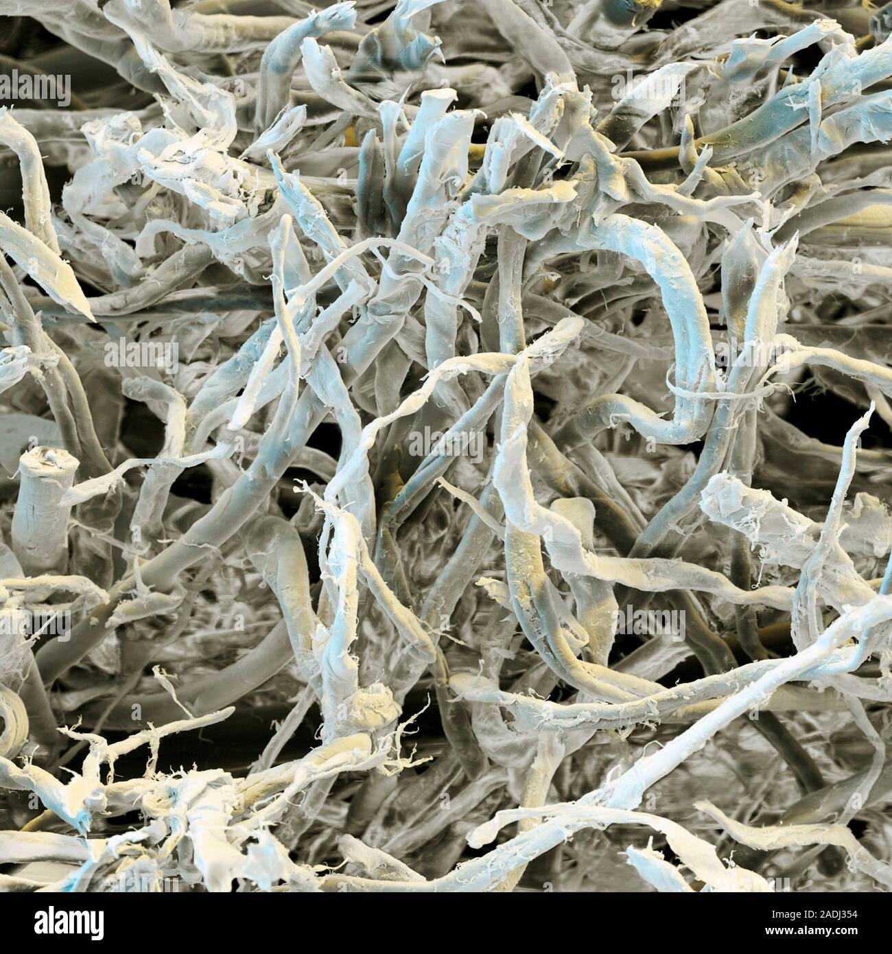 Absorbent wound dressing. Coloured scanning electron micrograph (SEM ...