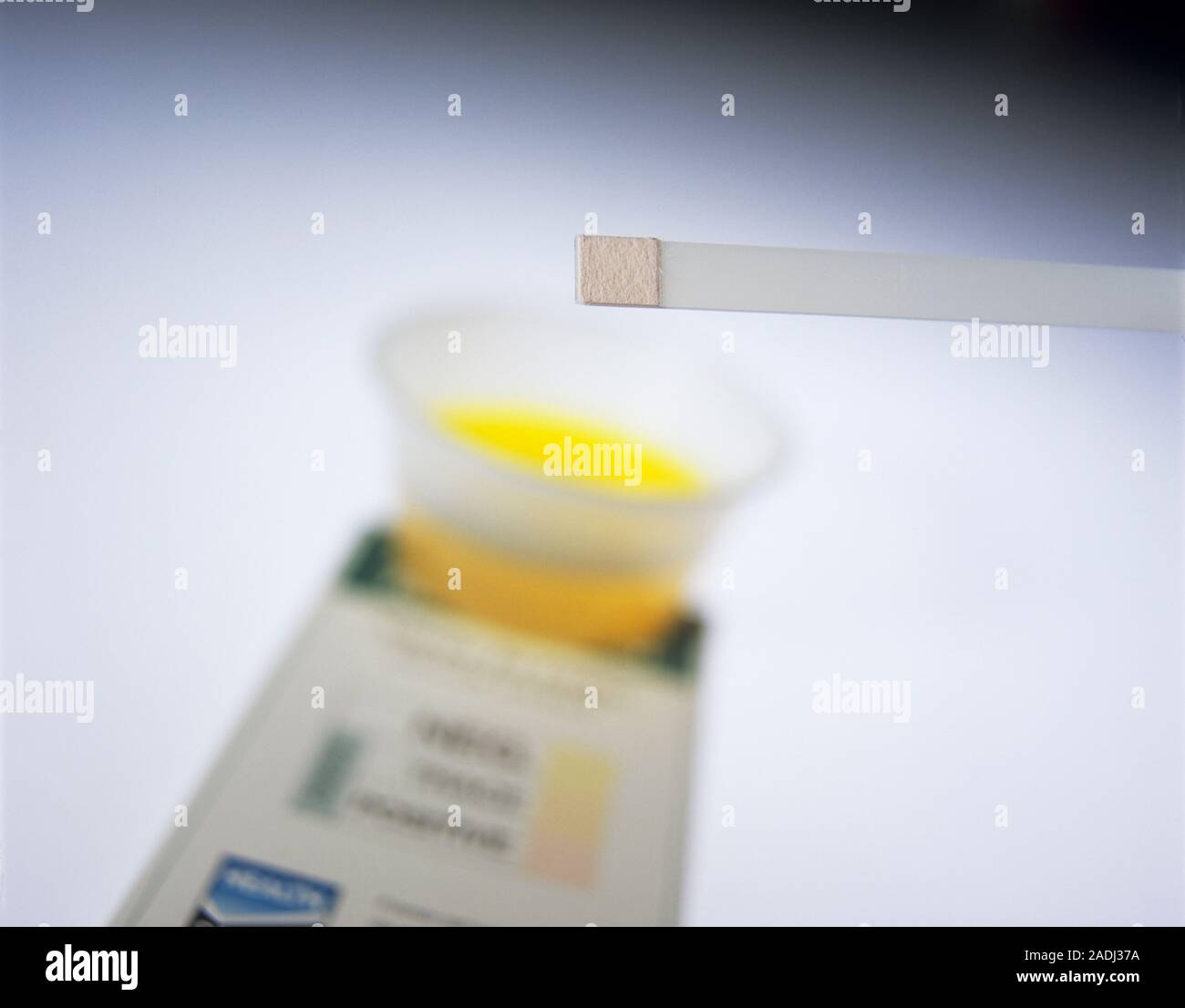 Urine testing. Urine test strip for urinary tract infection (UTI ...