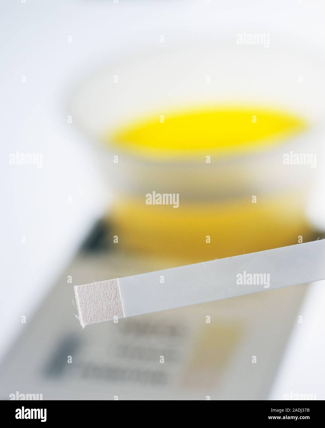 Urine testing. Urine test strip for urinary tract infection (UTI ...