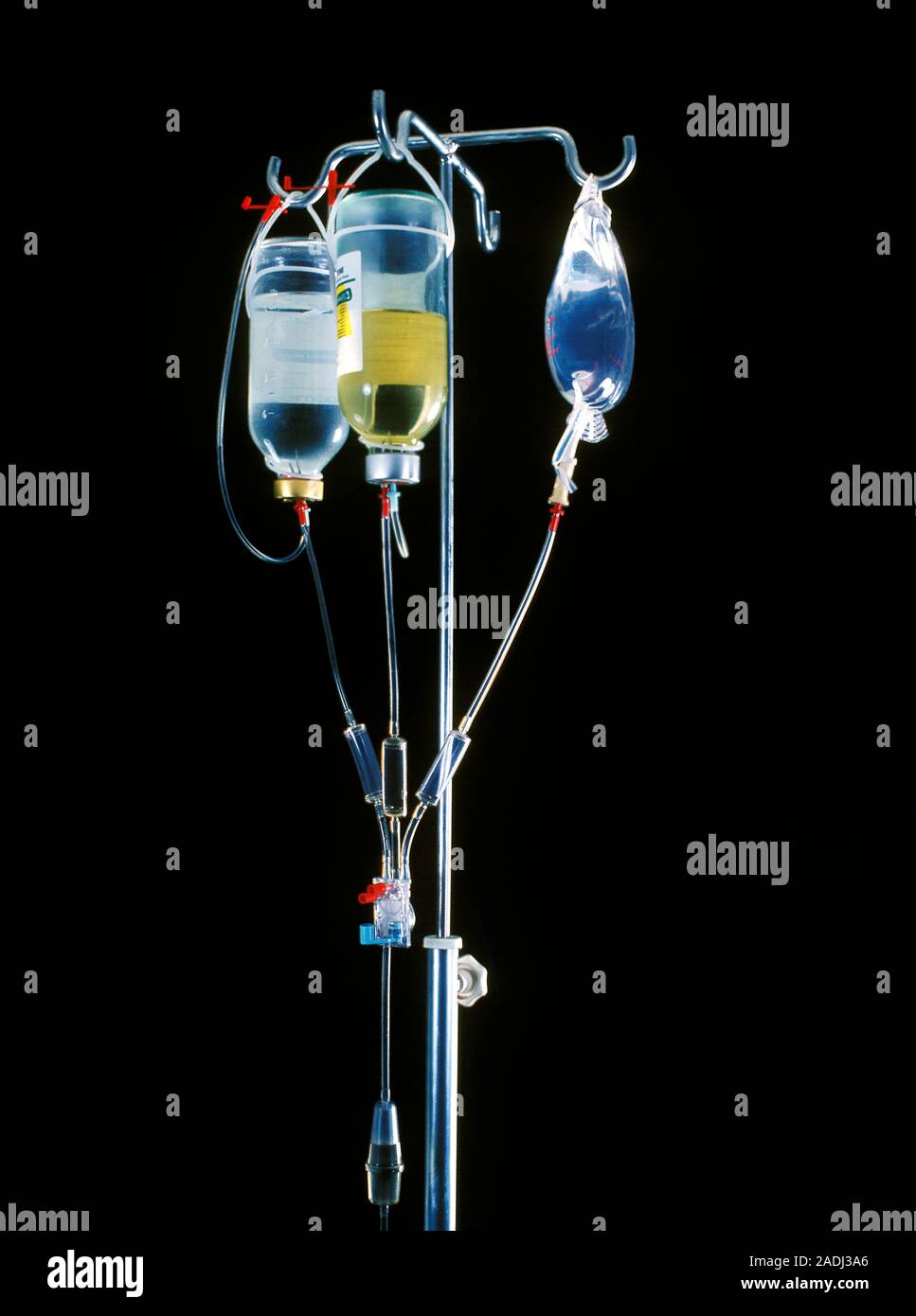 Intravenous drip stand with three bags on it. A drip is used to ...