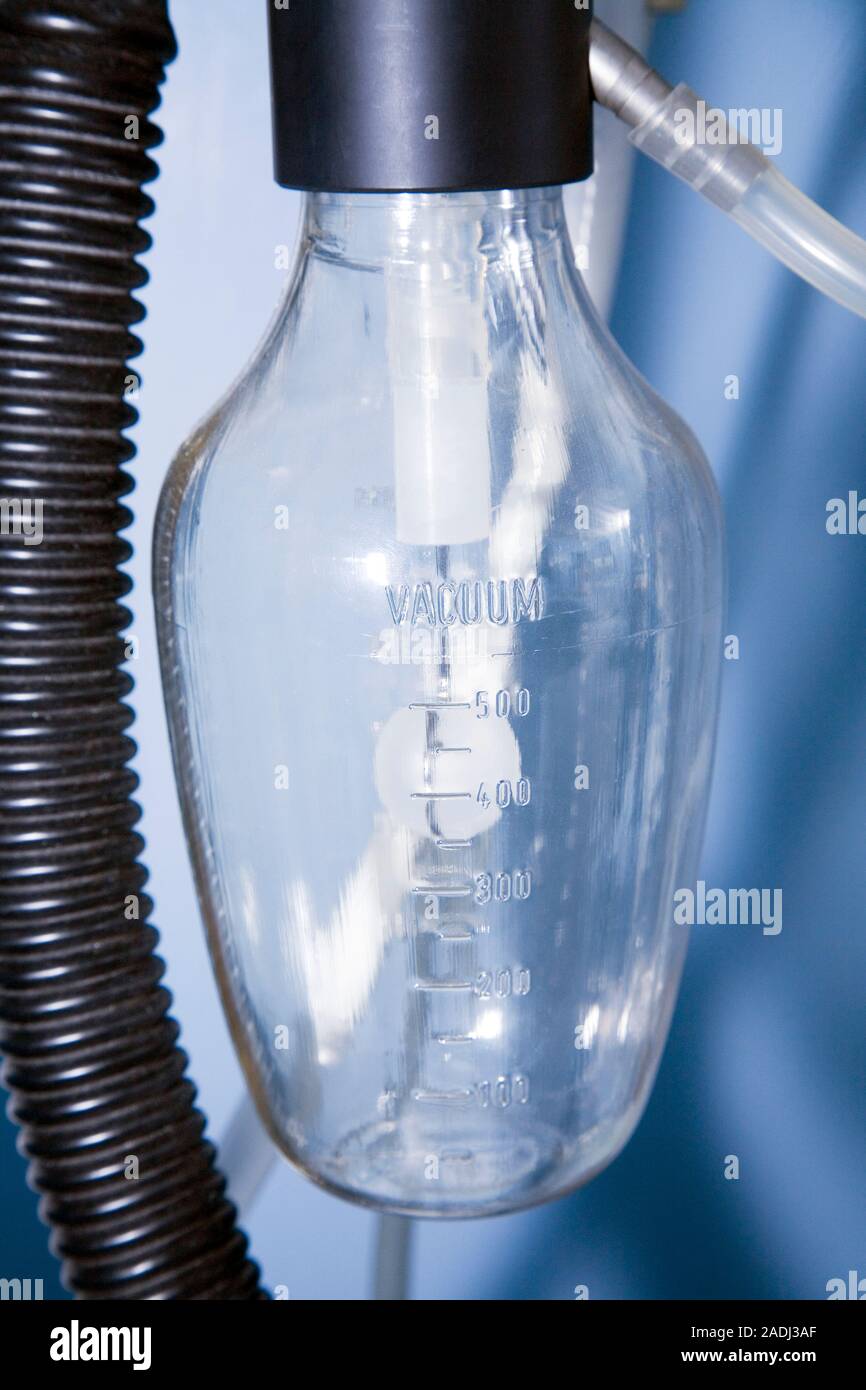 Medical suction unit drainage bottle. Medical suction units are used in ...