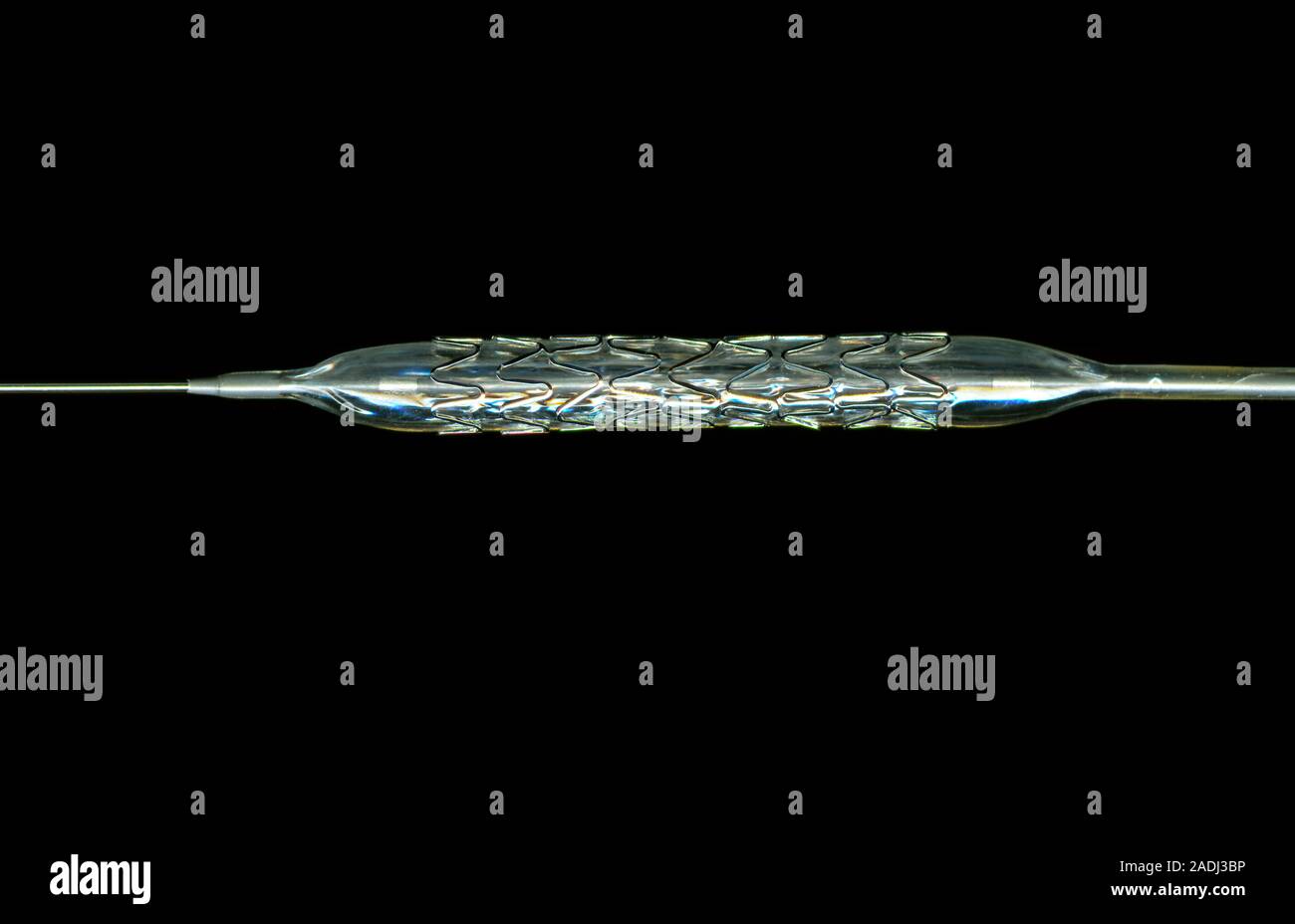 Coronary stent. This stent (wire mesh tube at centre) is used to treat ...
