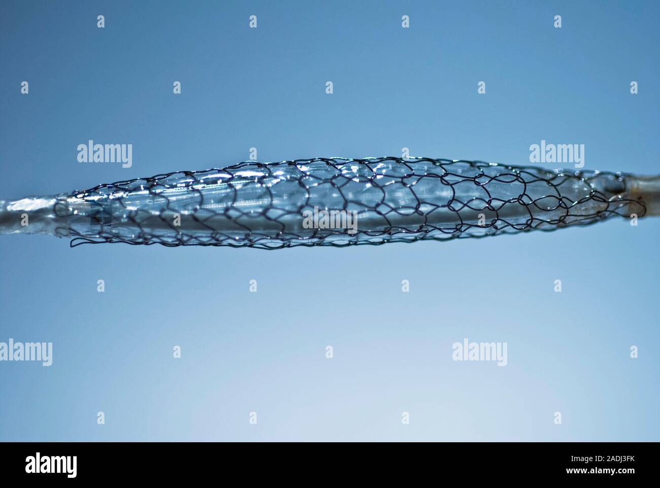 Inflated blood vessel stent. This stent (wire mesh tube) is used to ...