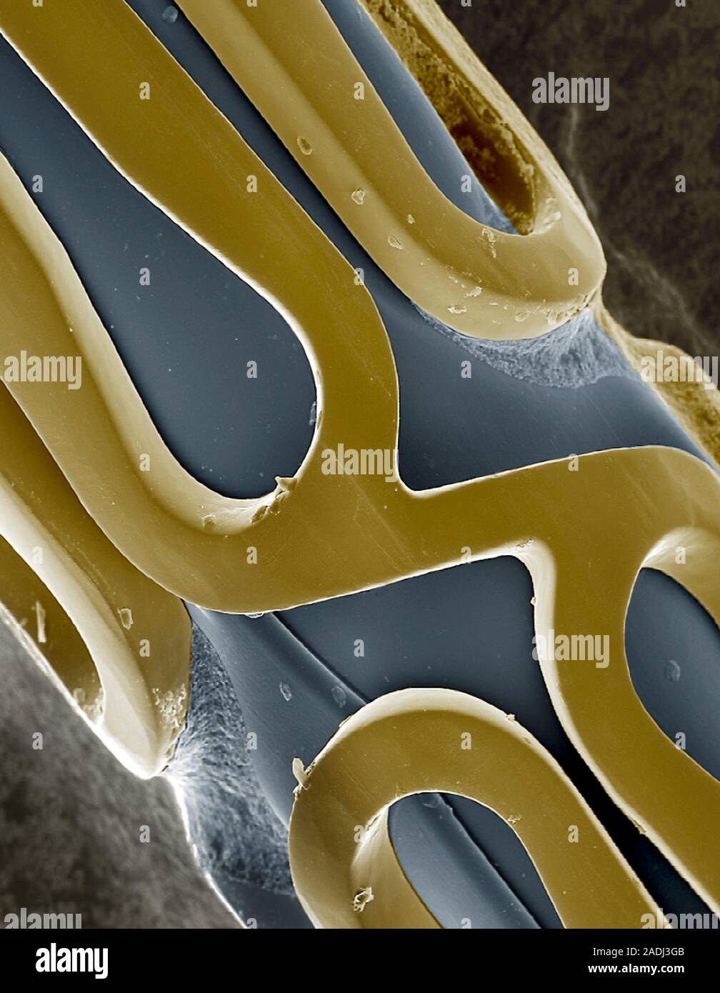 Coronary stent. Coloured scanning electron micrograph (SEM) of a stent ...