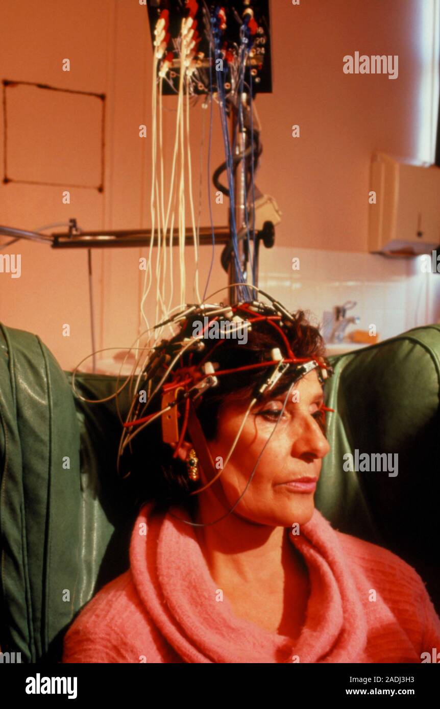 Electroencephalography (EEG) testing for Alzheimer's disease, showing a ...