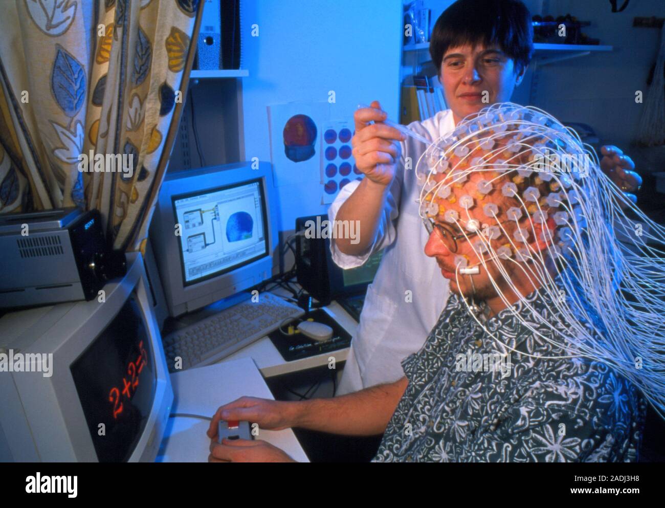 EEG brain study. Subject undergoing an electro- encephalogram (EEG ...