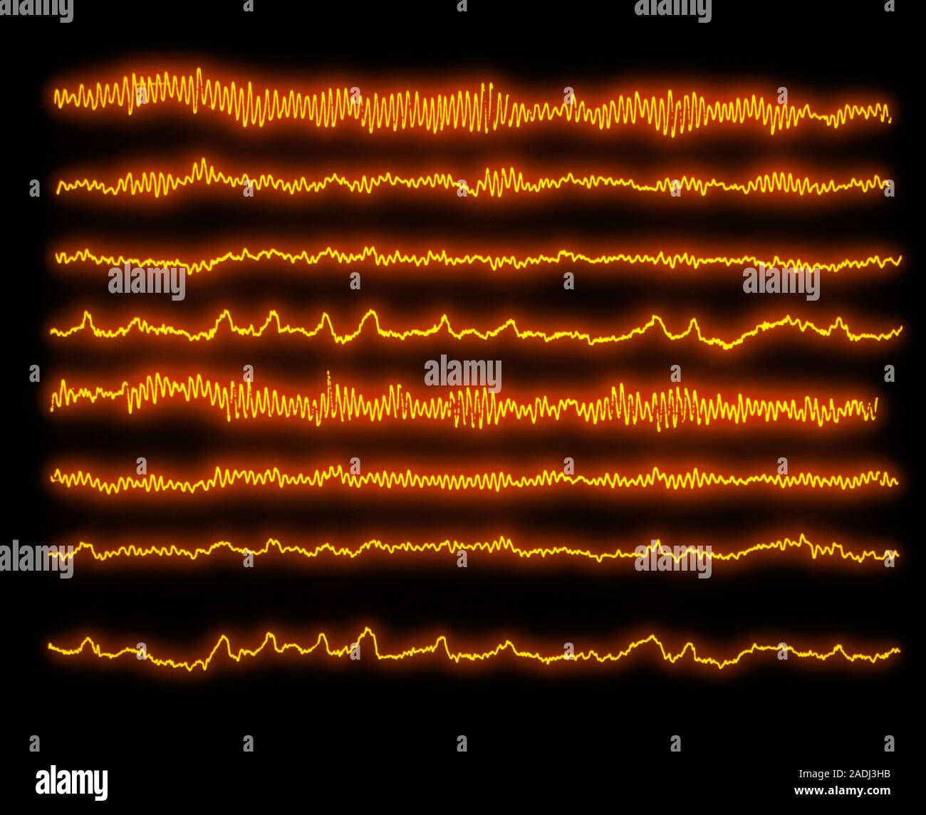 Healthy EEG. Coloured image of a healthy electro- encephalogram (EEG ...