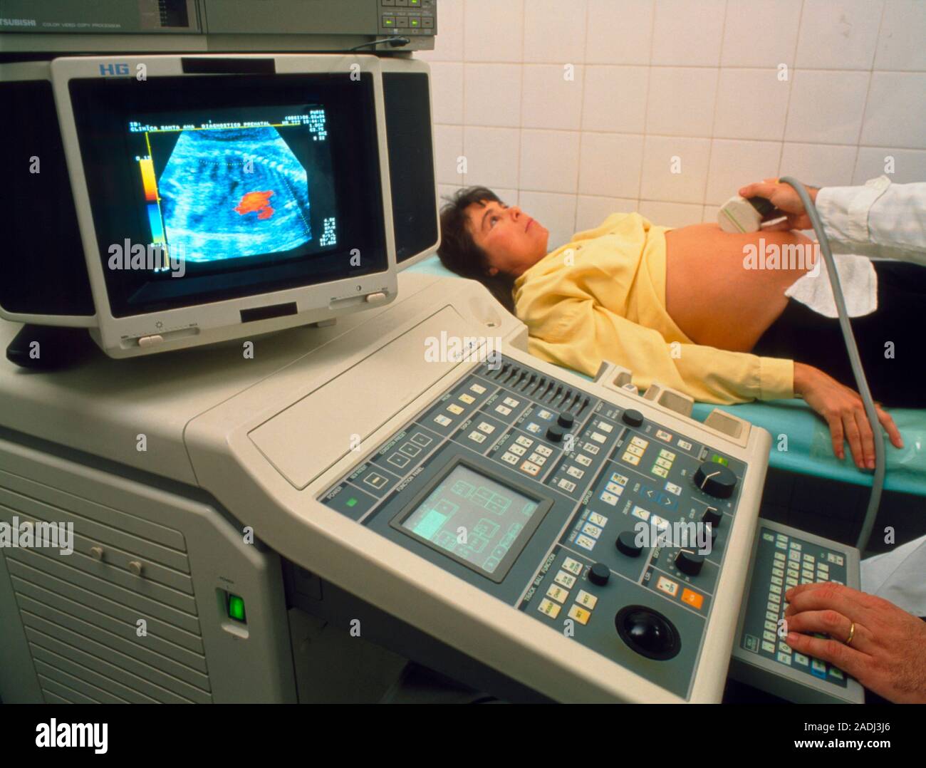 Doppler ultrasound of pregnant woman. A doctor holds an ultrasound ...