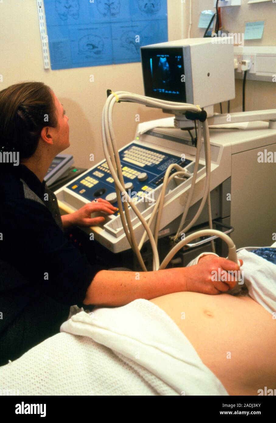 Ultrasound scan. Female patient having her abdomen scanned by ...