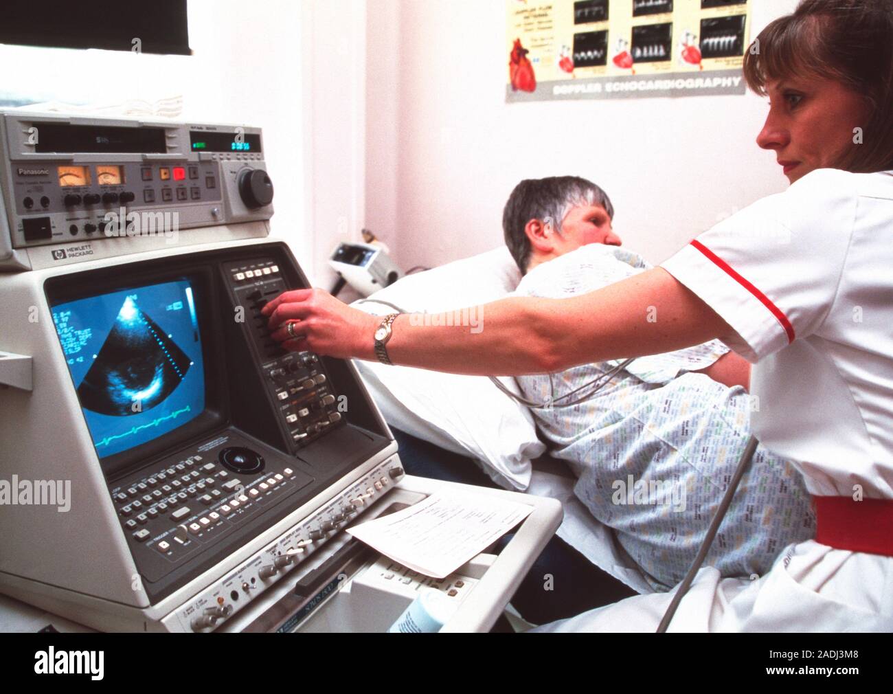 Heart ultrasound scan. Nurse using an echocardiograph machine to study ...
