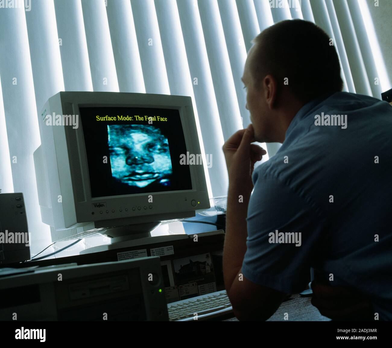 Foetal ultrasound. Gynaecologist studying a 3-D ultrasound scan of the ...